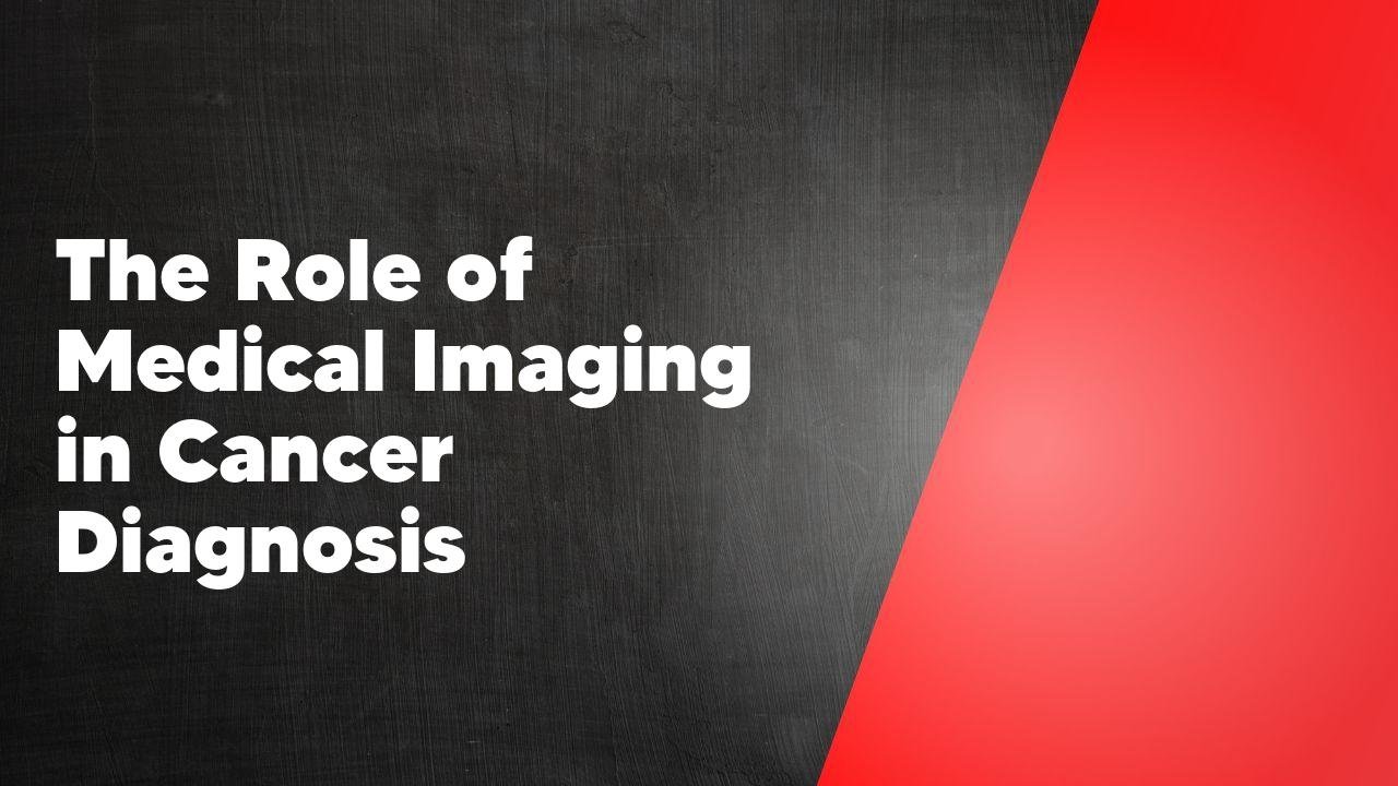The Role of Medical Imaging in Cancer Diagnosis - Machinery.directory